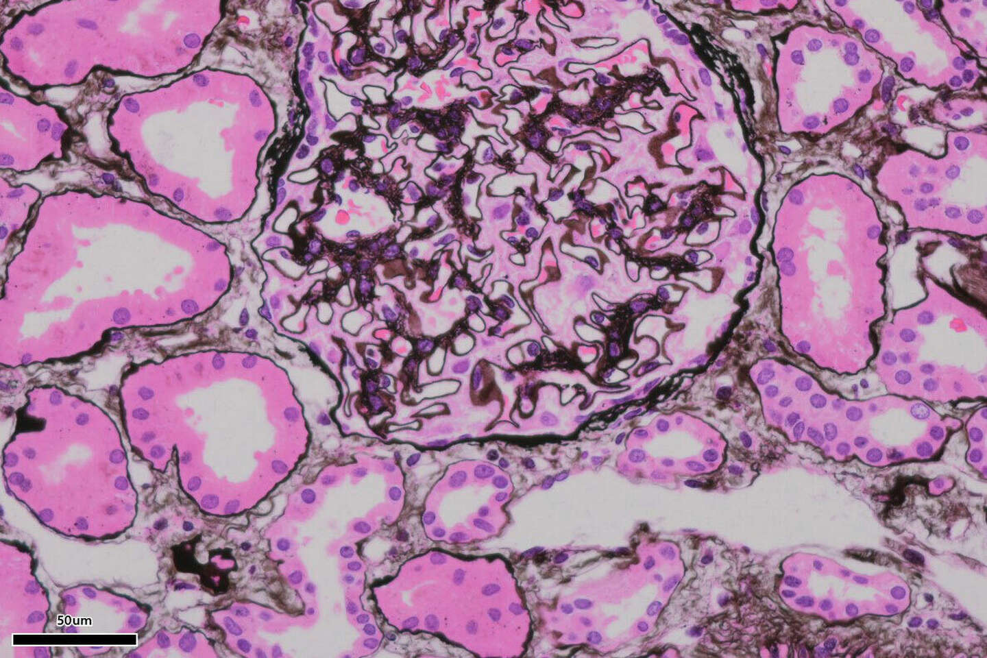 ECLIPSE Ui | Digital Microscopes | Microscope Products | Nikon ...