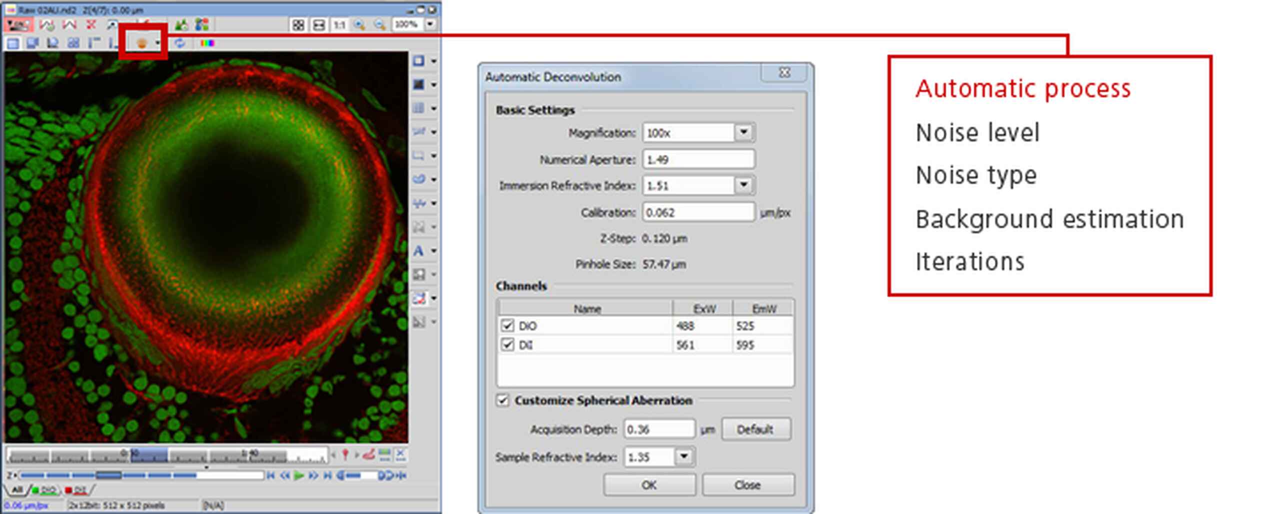NIS-Elements 共聚焦 | NIS-Elements | 软件 | 显微镜产品 | 尼康精机（上海）有限公司