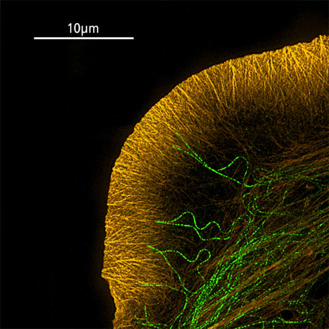 N-SIM E | Super-Resolution Microscopes | Microscope Products | Nikon ...