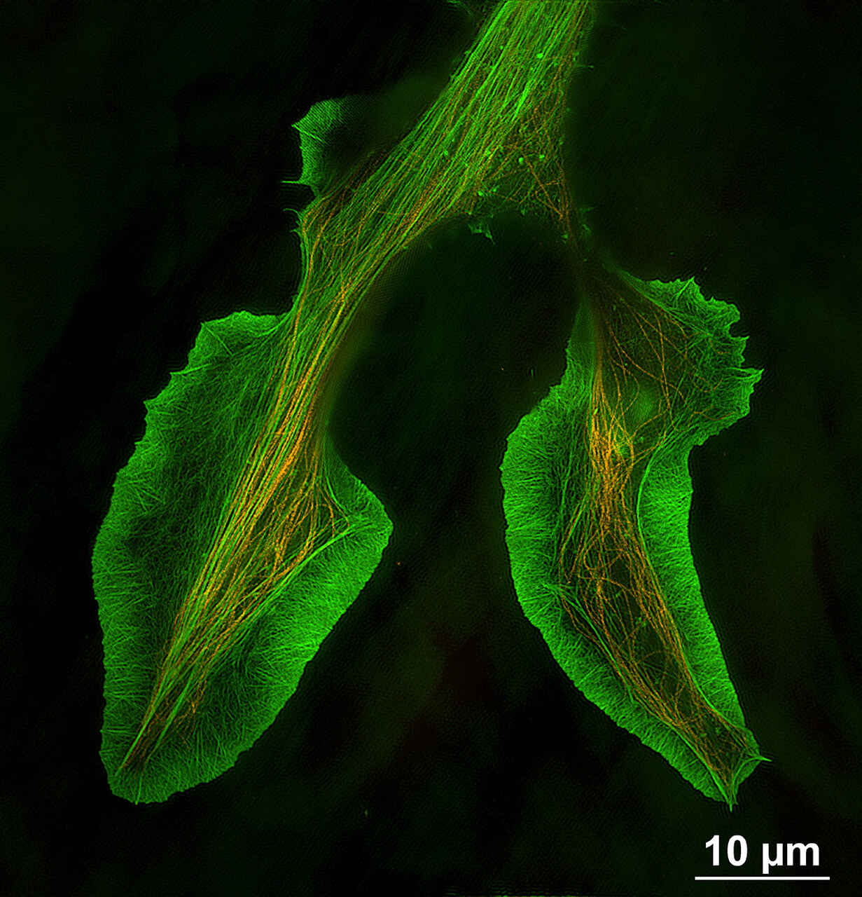 N-SIM S | Super-Resolution Microscopes | Microscope Products | Nikon ...