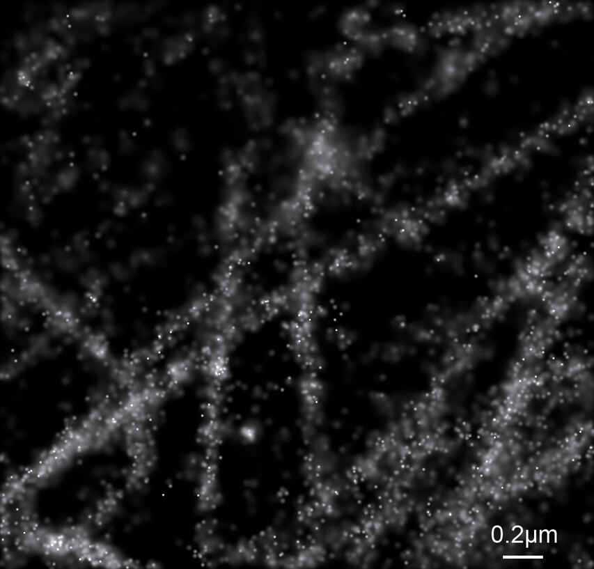 N-STORM | Super-Resolution Microscopes | Microscope Products | Nikon ...