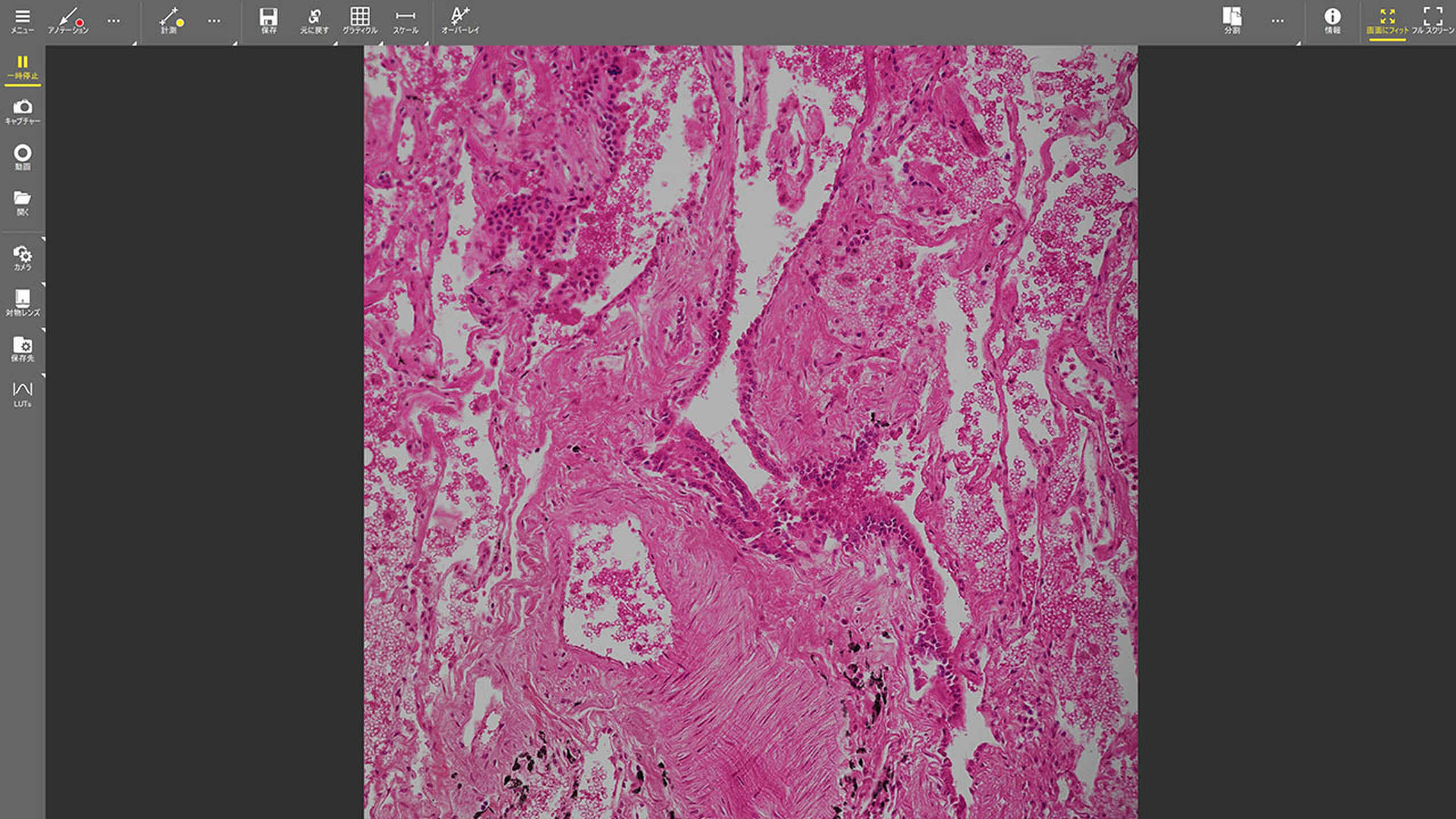 NIS-Elements L | NIS-Elements | Software | Microscope Products | Nikon ...