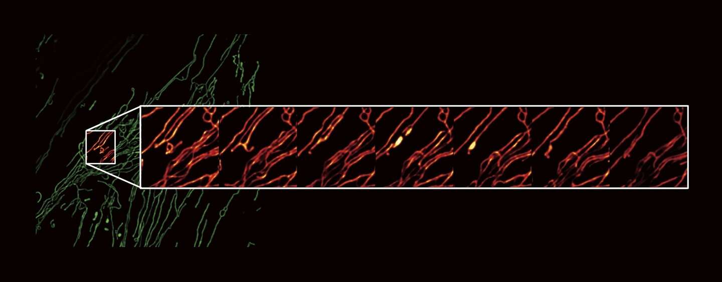 AX / AX R with NSPARC | AX / AX R with NSPARC | 共聚焦和多光子显微镜 | 显微镜产品 | 尼康精机（上海）有限公司