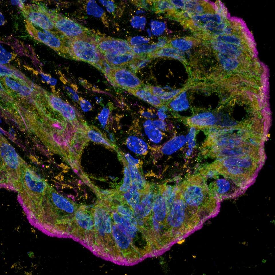 AX / AX R with NSPARC | AX / AX R with NSPARC | 共聚焦和多光子显微镜 | 显微镜产品 | 尼康精机（上海）有限公司