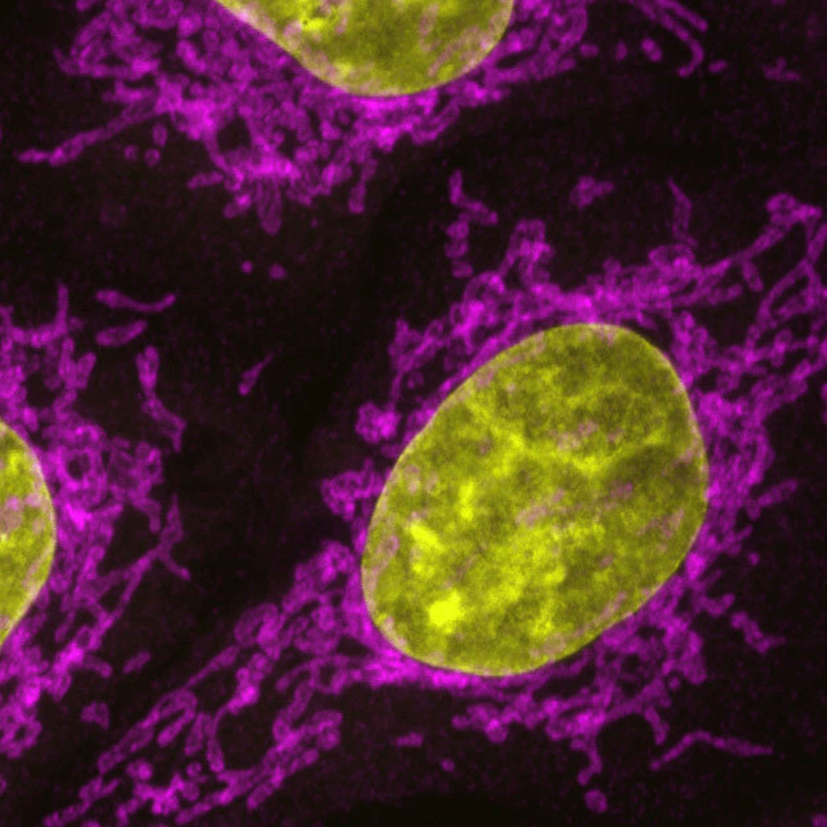 Ax Ax R With Nsparc Ax Ax R With Nsparc Confocal And
