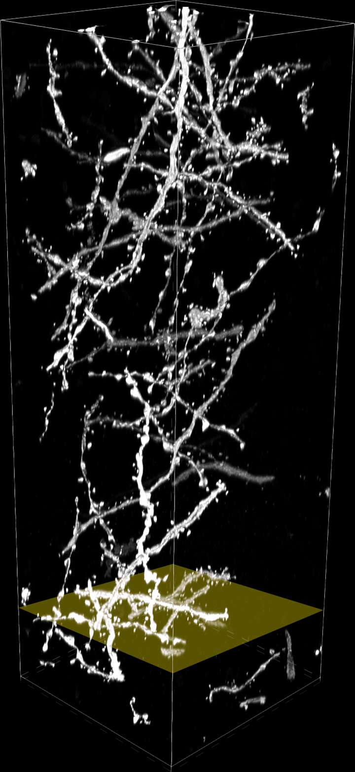 Ax Ax R With Nsparc Ax Ax R With Nsparc Confocal And