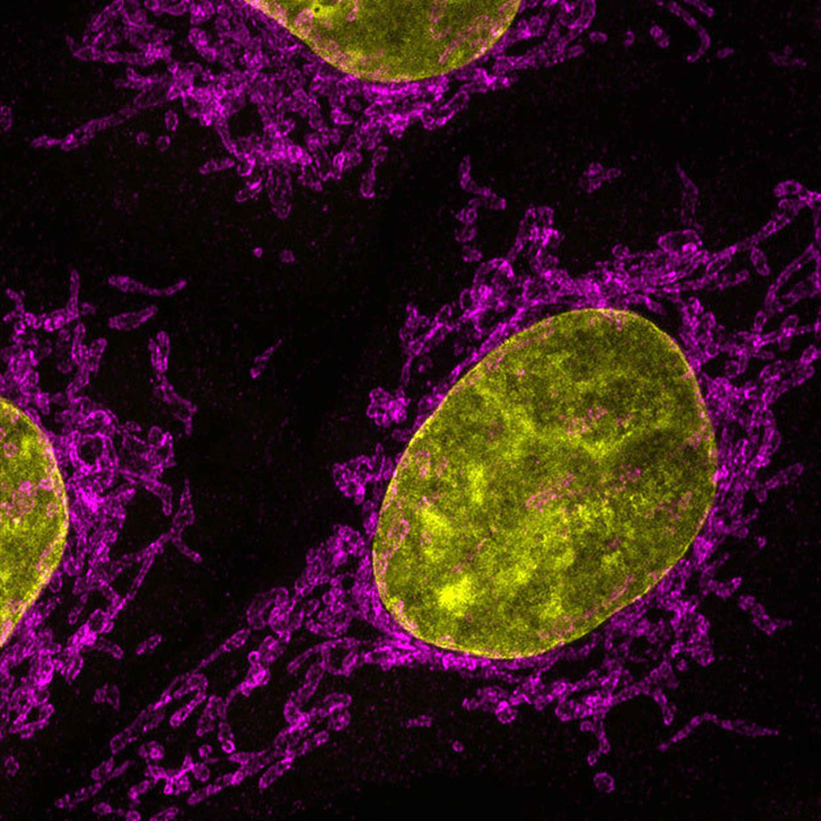 AX / AX R with NSPARC | AX / AX R with NSPARC | Confocal and ...