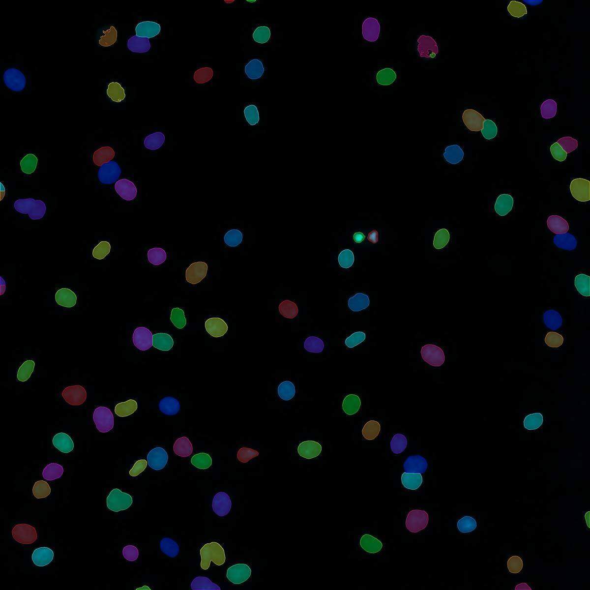 Custom Image Processing and Analysis | Applications | Nikon BioImaging ...