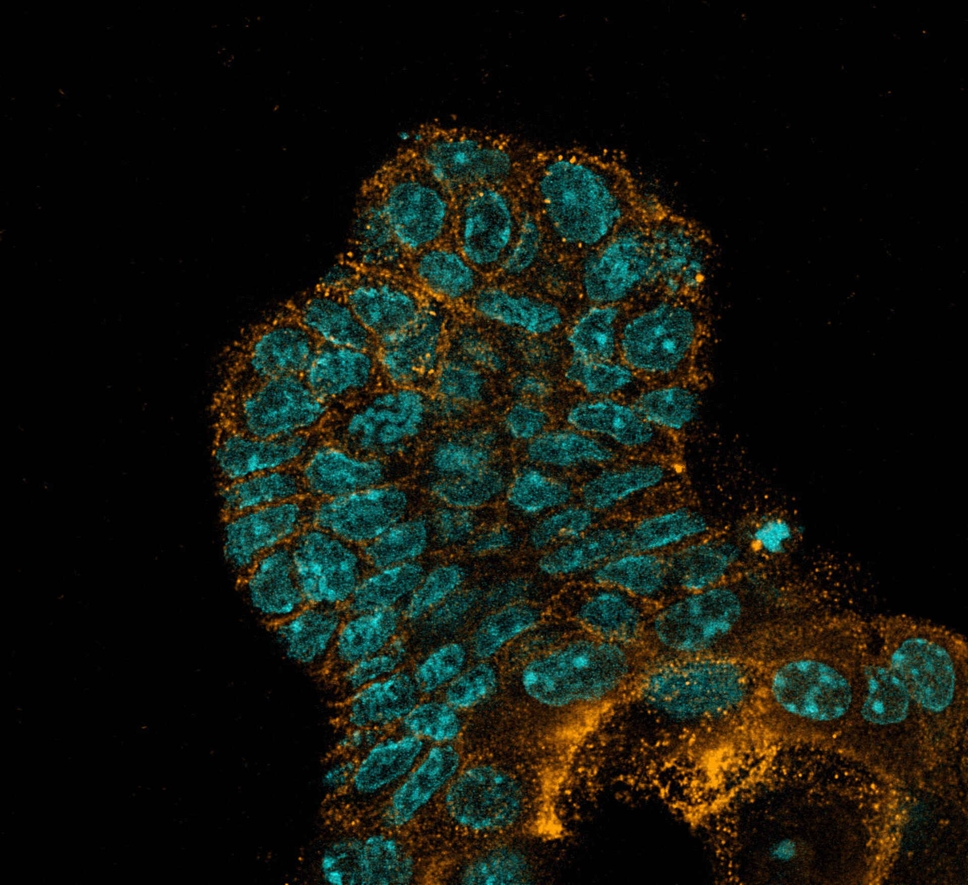 Silicone Immersion Series | Optics | Microscope Products | Nikon ...
