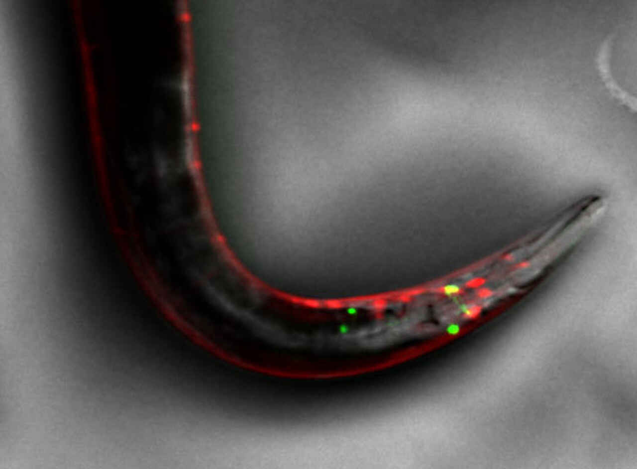 SMZ25 / SMZ18 | Stereo Microscopes | Microscope Products | Nikon ...