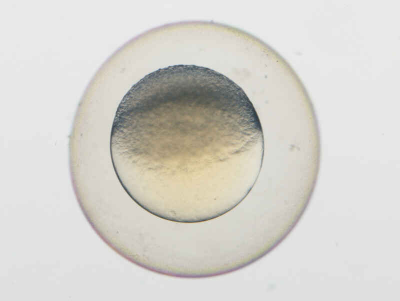 SMZ25 / SMZ18 | Stereo Microscopes | Microscope Products | Nikon ...