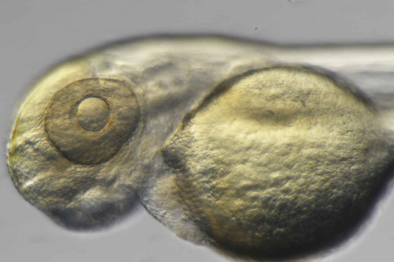 SMZ25 / SMZ18 | Stereo Microscopes | Microscope Products | Nikon ...