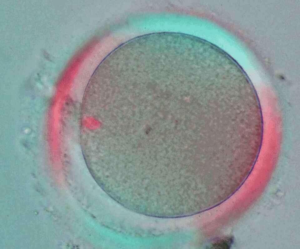 ECLIPSE Ti2-I | Inverted Microscopes | Microscope Products | Nikon ...