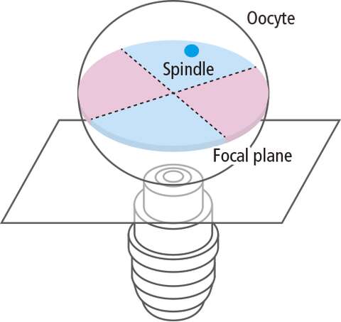 ECLIPSE Ti2-I | Inverted Microscopes | Microscope Products | Nikon ...