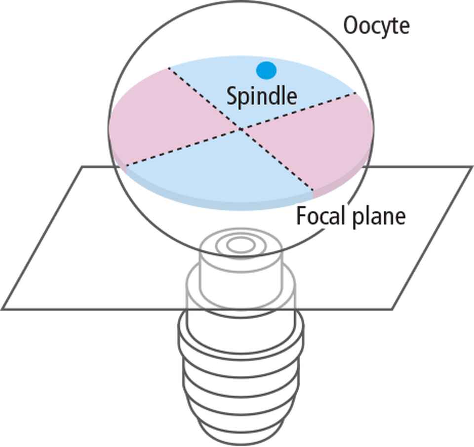 ECLIPSE Ti2-I | Inverted Microscopes | Microscope Products | Nikon ...