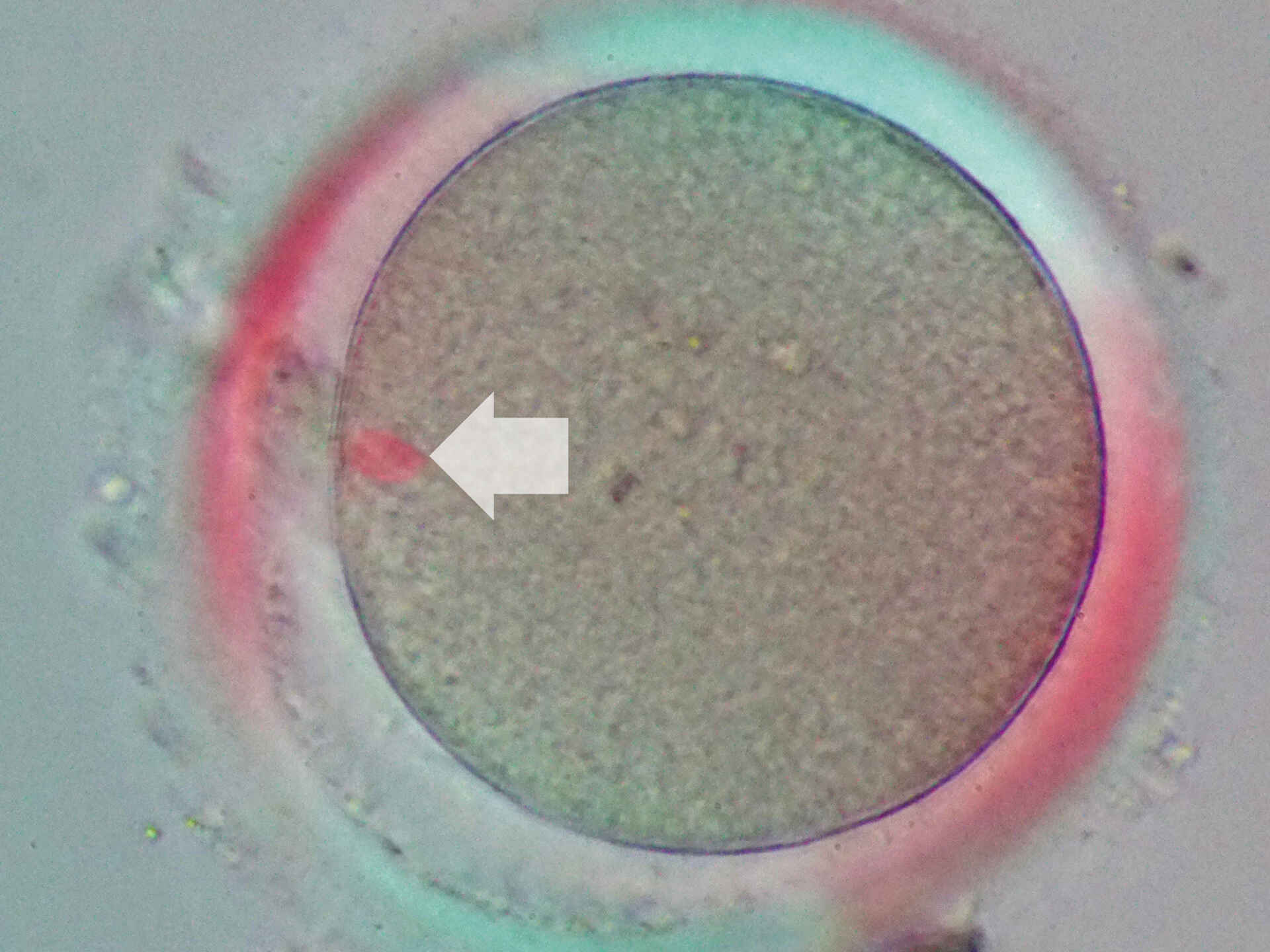 ECLIPSE Ti2-U IVF | Inverted Microscopes | Microscope Products | Nikon ...