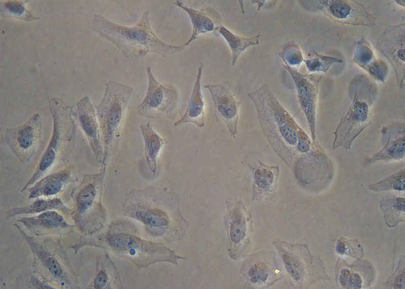 ECLIPSE Ts2 | Inverted Microscopes | Microscope Products | Nikon ...