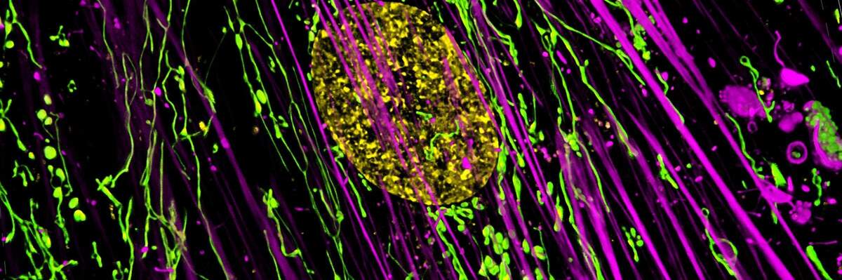 AX / AX R with NSPARC | AX / AX R with NSPARC | Confocal and ...