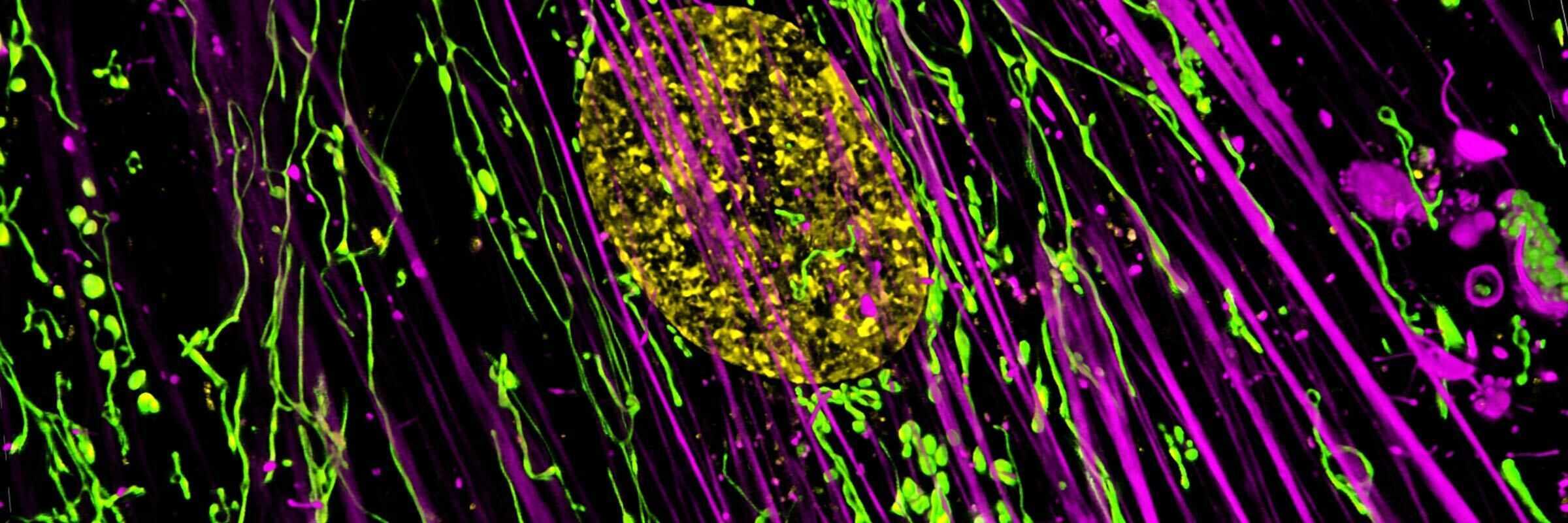 AX / AX R with NSPARC | Confocal and Multiphoton Microscopes ...