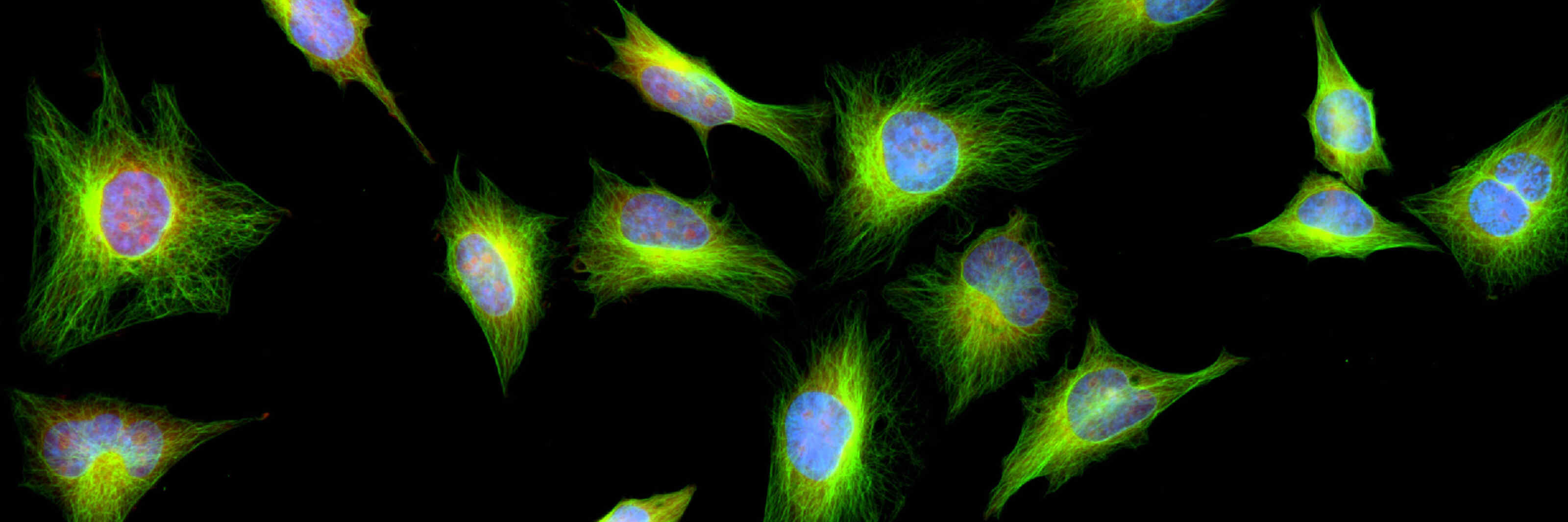 D-LEDI | Light Sources | Microscope Products | Nikon Instruments Inc.