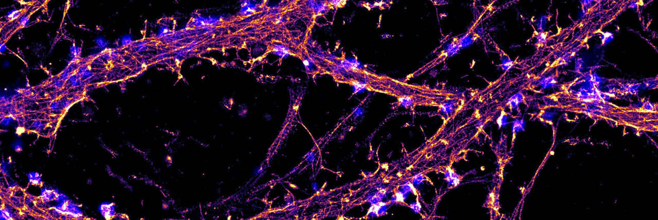 BioImaging Centers | | Nikon Instruments Inc.