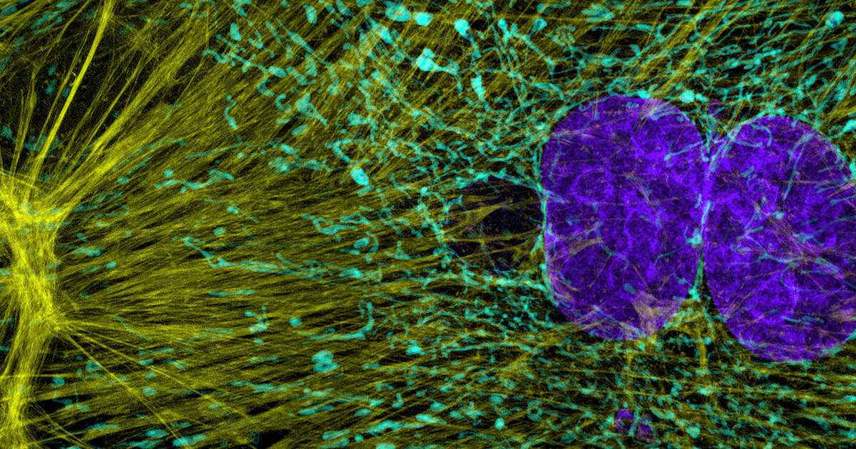 2D Imaging | Applications | Nikon BioImaging Lab - USA | Nikon ...