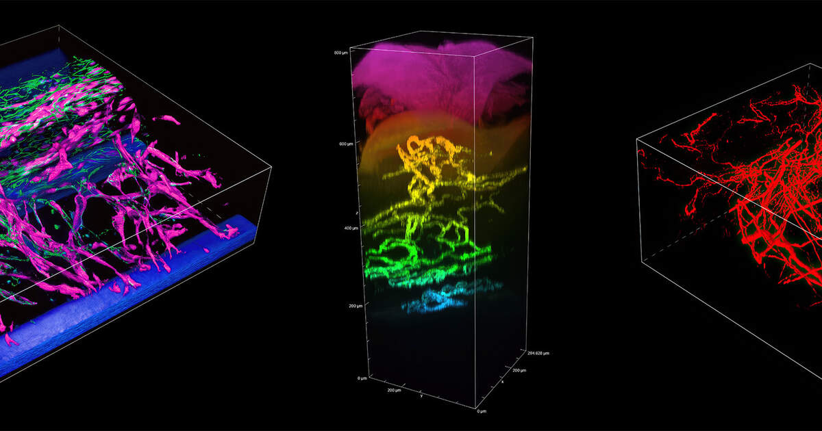 3D Imaging | Applications | Nikon BioImaging Lab - Europe | Nikon ...