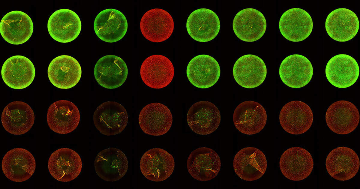 Frequently Asked Questions | Nikon BioImaging Lab - Europe | Nikon ...