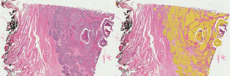 Histological Image Segmentation | Applications | Nikon BioImaging Lab ... Histological Image Segmentation | Applications | Nikon BioImaging Lab ...
