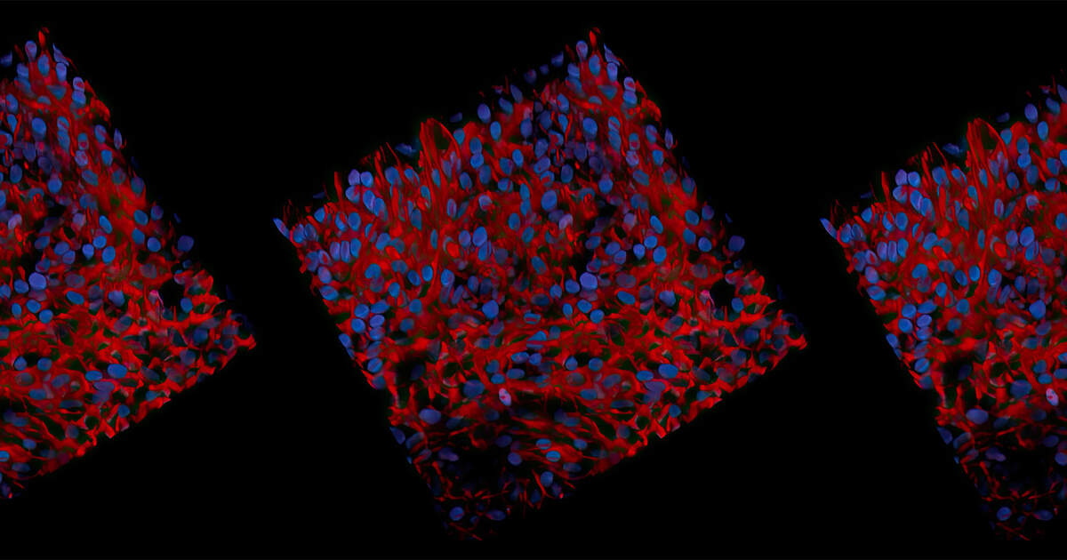 Organ-on-chip Applications | Applications | Nikon BioImaging Lab ...
