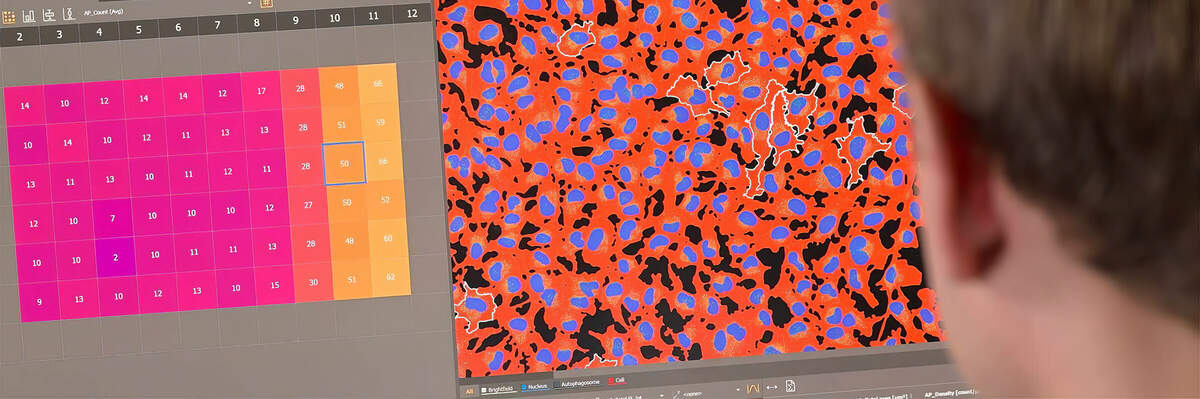 Research Services | Nikon BioImaging Lab - Boston, USA | Nikon ...