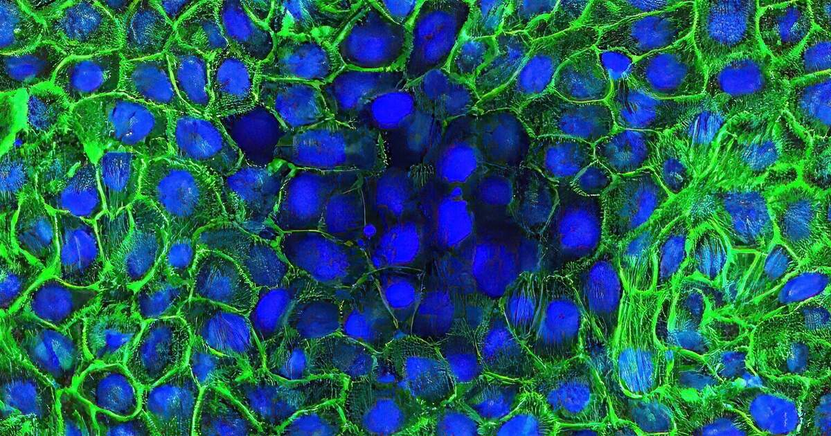 Pre-clinical Toxicology Services | Applications | Nikon BioImaging Lab ...