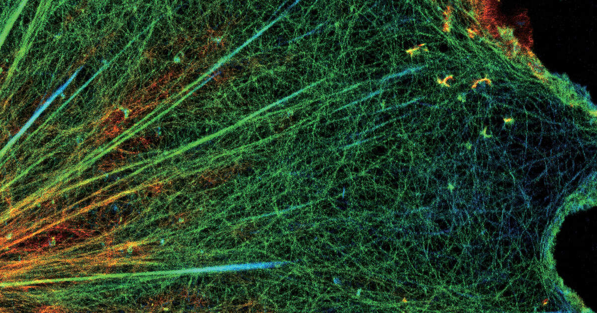 Super-Resolution | Applications | Nikon BioImaging Lab - Boston, USA ...