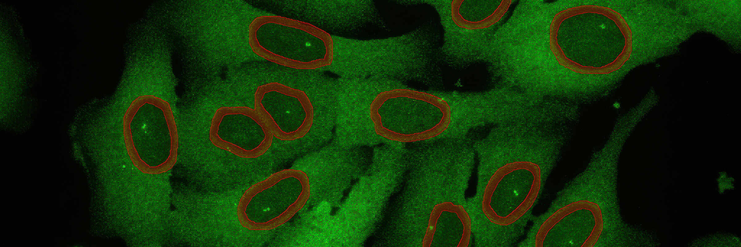 Frequently Asked Questions | Nikon BioImaging Lab - USA | Nikon ...