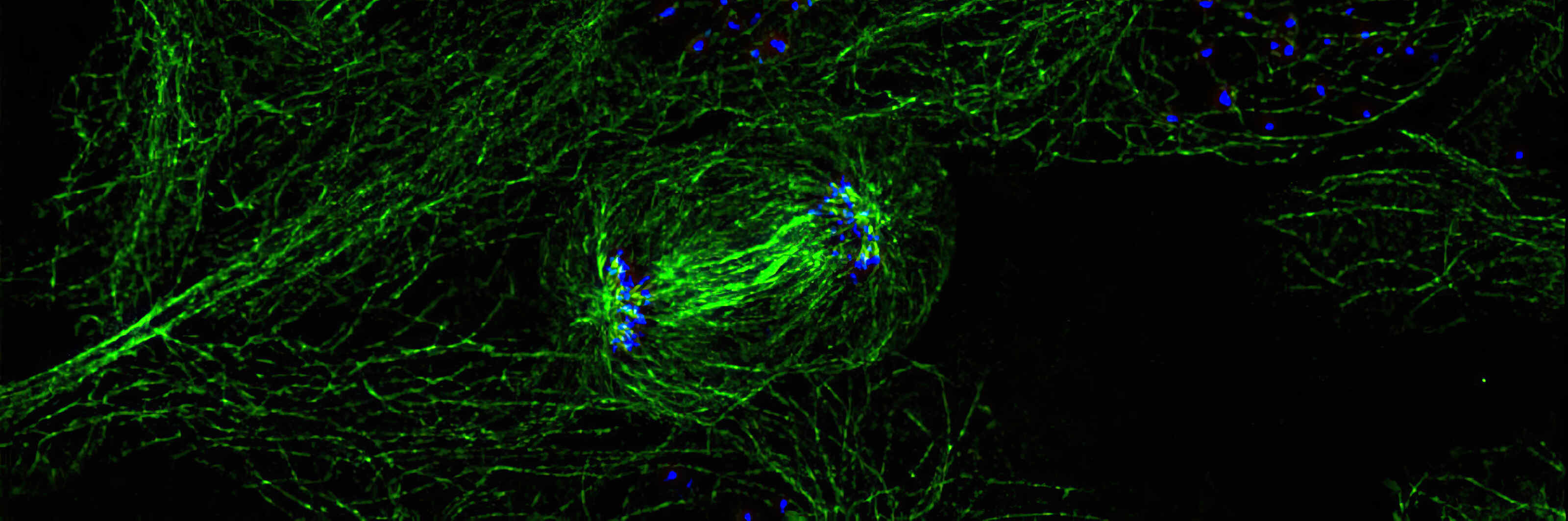X-Light V3/DeepSIM | CrestOptics X-Light Series | Confocal and ...