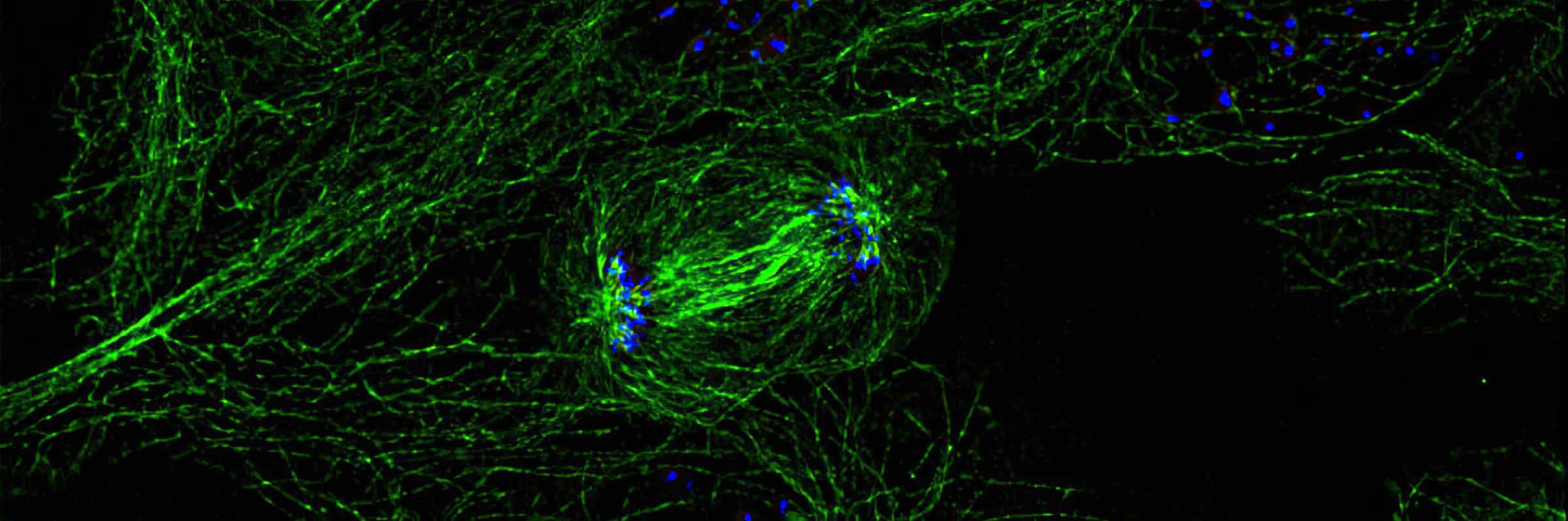 Crest X-Light V3 | Crest X-Light Series | Confocal and Multiphoton ...
