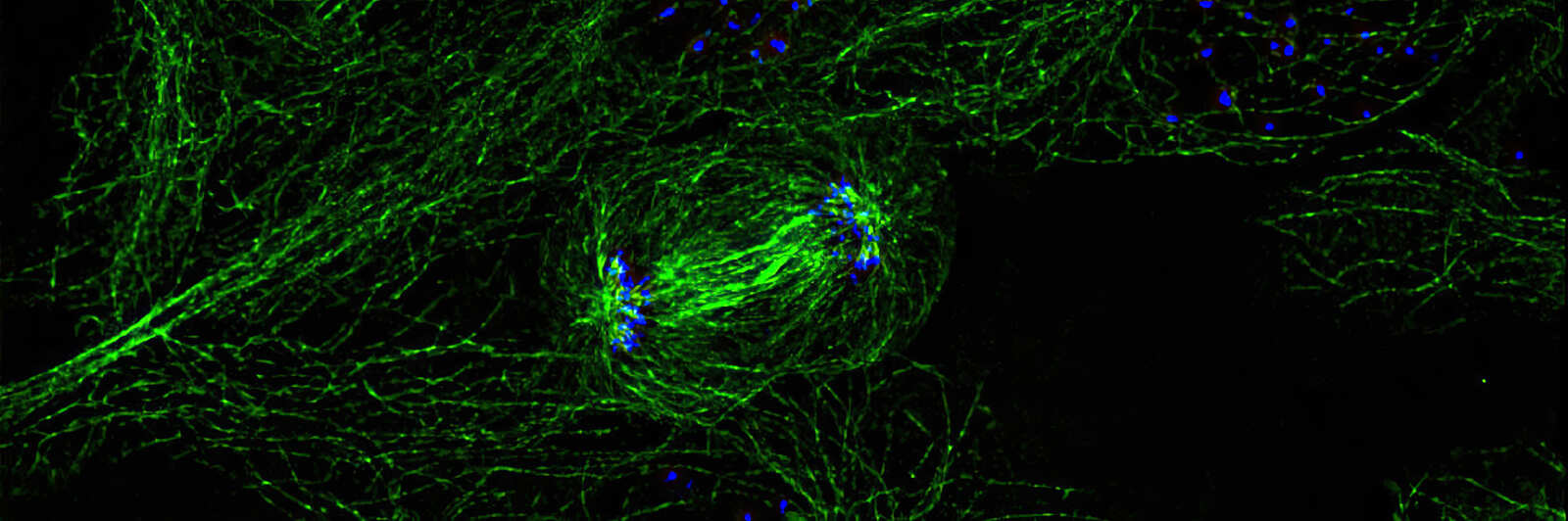 CrestOptics X-Light Series | Confocal and Multiphoton Microscopes ...