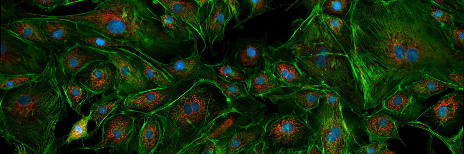 HGプリセンタファイバ光源 Intensilight C-HGFIE（電動タイプ） / C-HGFI（手動タイプ） | 光源 | 製品 ...