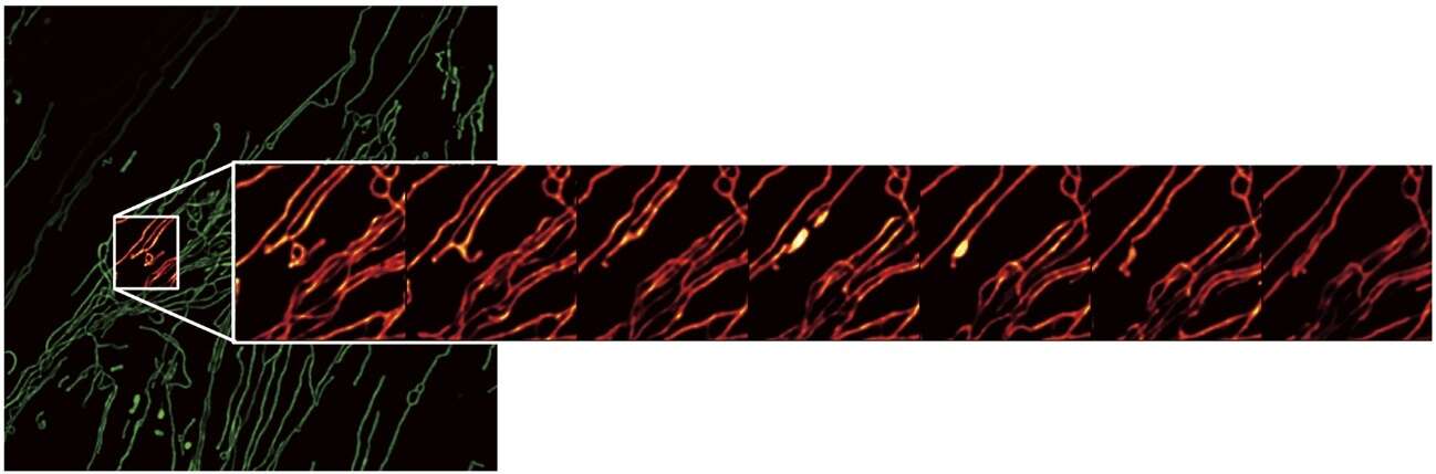 Nikon introduces all new Spatial Array Confocal (NSPARC) Detector for ...