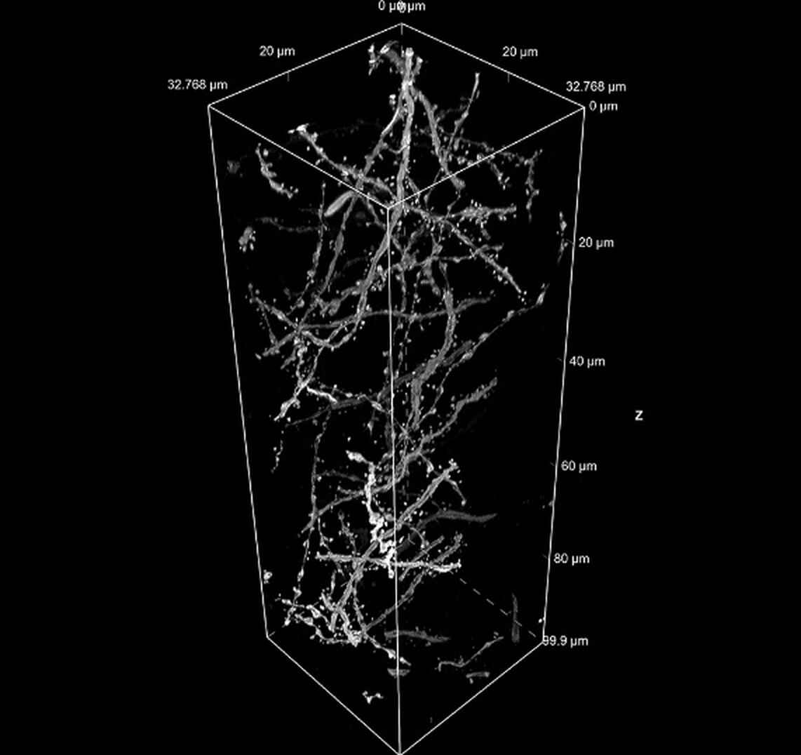 Nikon introduces all new Spatial Array Confocal (NSPARC) Detector for ...