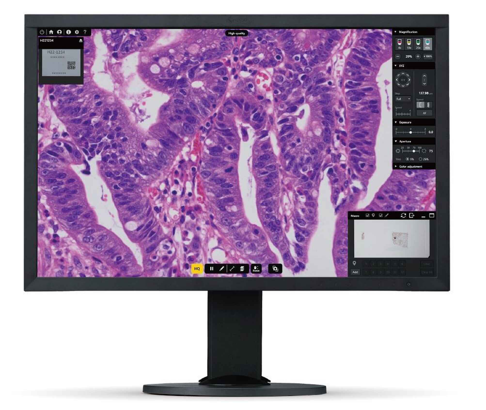 Nikon introduces the ECLIPSE Ui Upright Digital Microscope | News ...