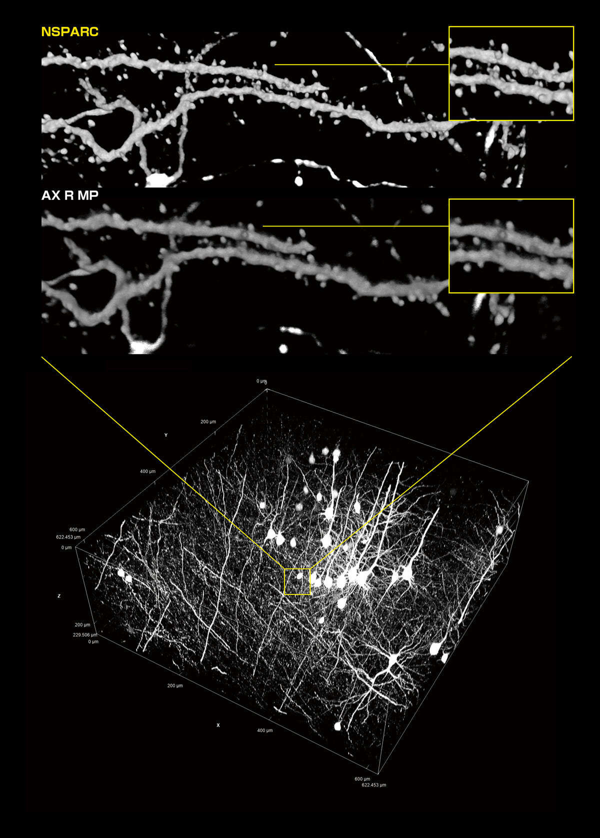 Nikon Introduces The Ax R Mp With Nsparc Super Resolution Multiphoton