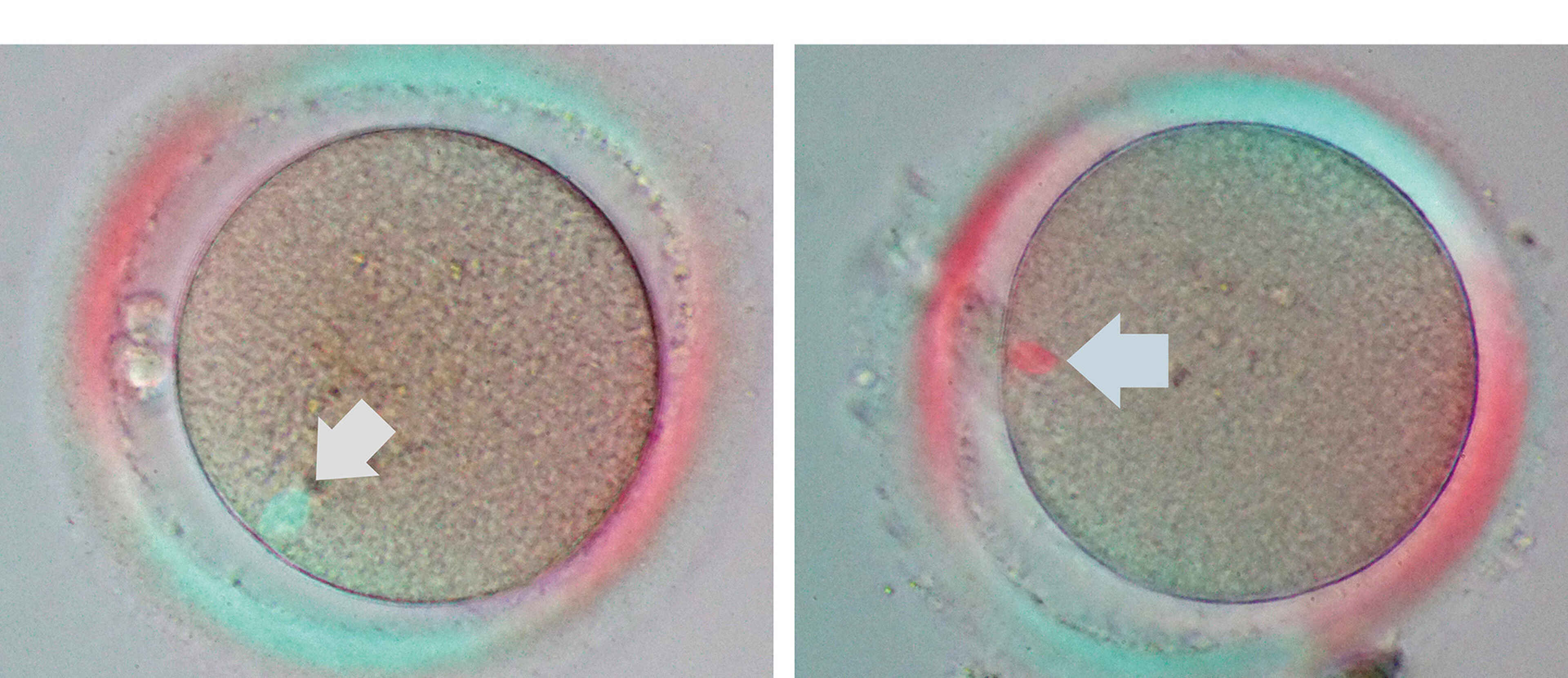 ECLIPSE Ti2-I motorized inverted microscope for reproductive medicine ...