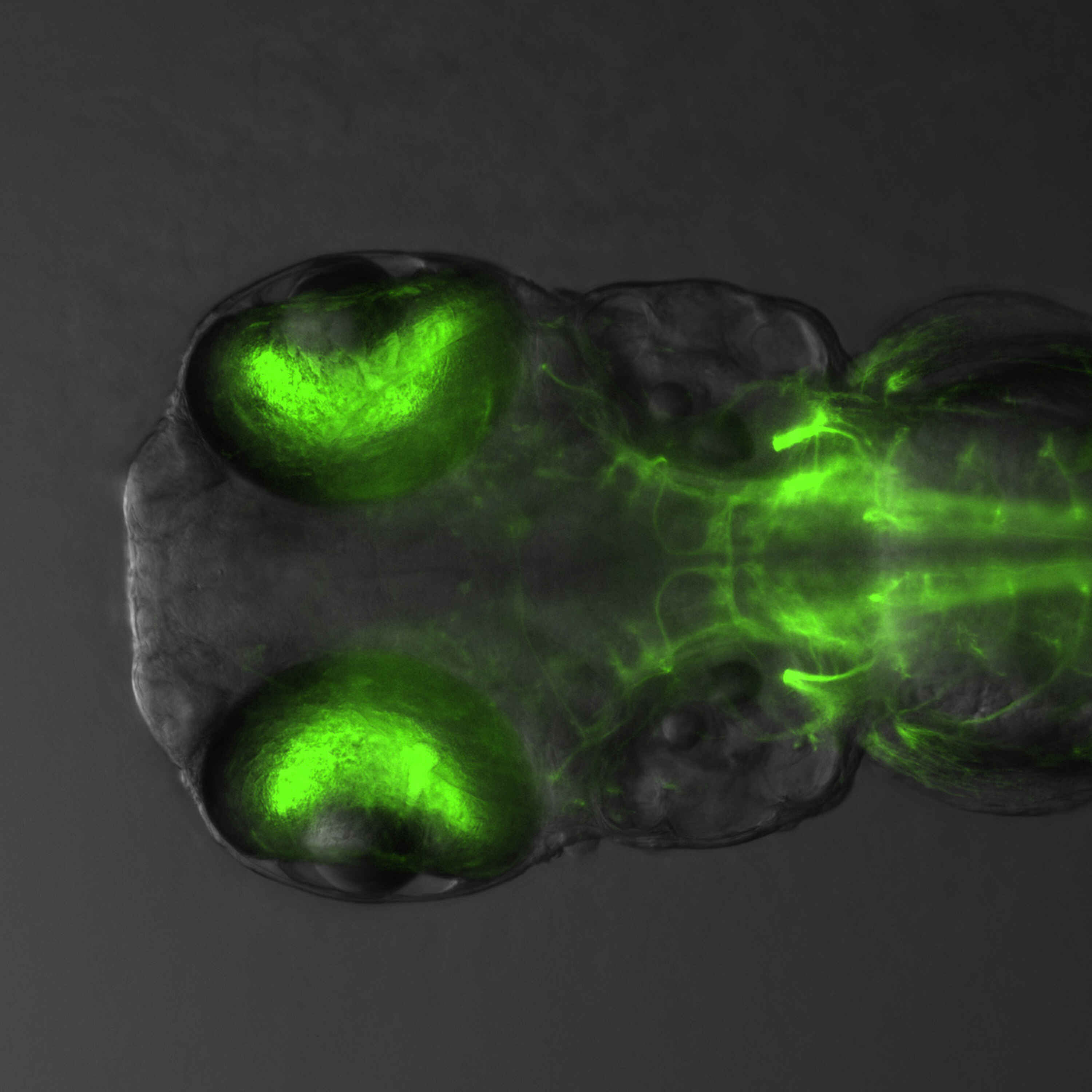 Nikon releases epi-fluorescence attachments for stereo microscopes ...