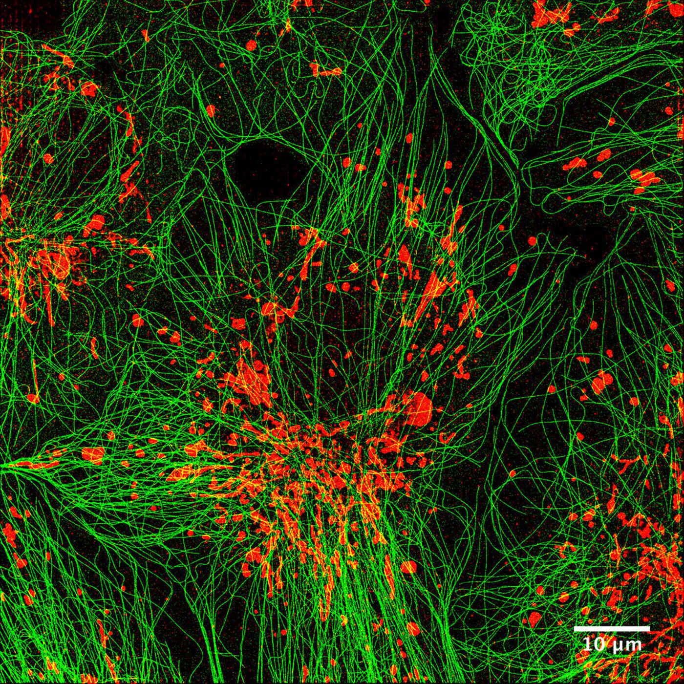 Nikon Single Molecule Imaging Contest Winners | News | Nikon ...