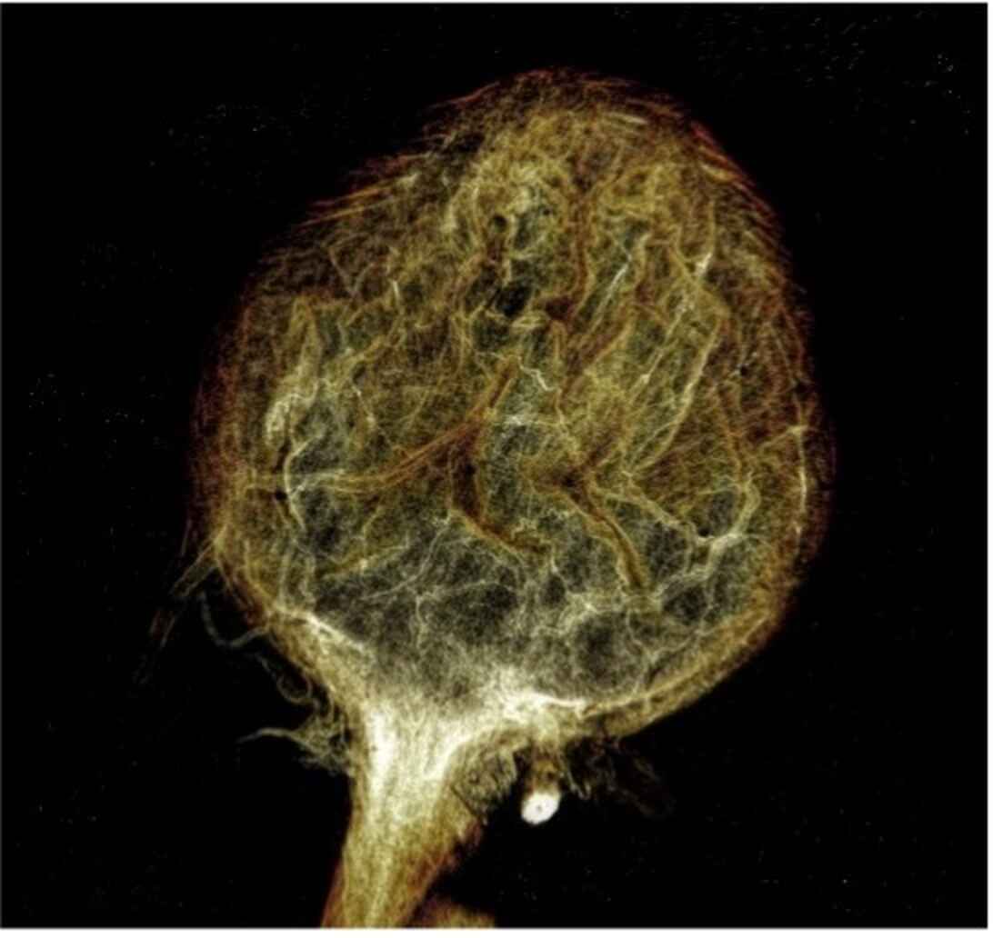 Nikon introduces the AX and AX R confocal microscope systems, with 8K ...