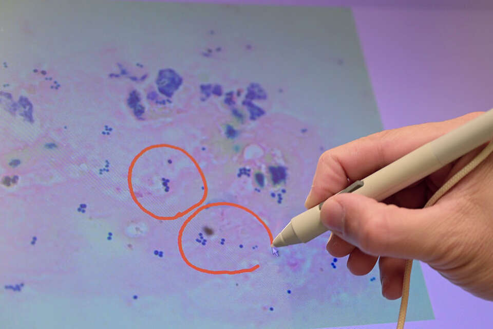 Interviews | ECLIPSE Si | Upright Microscopes | Microscope Products ...