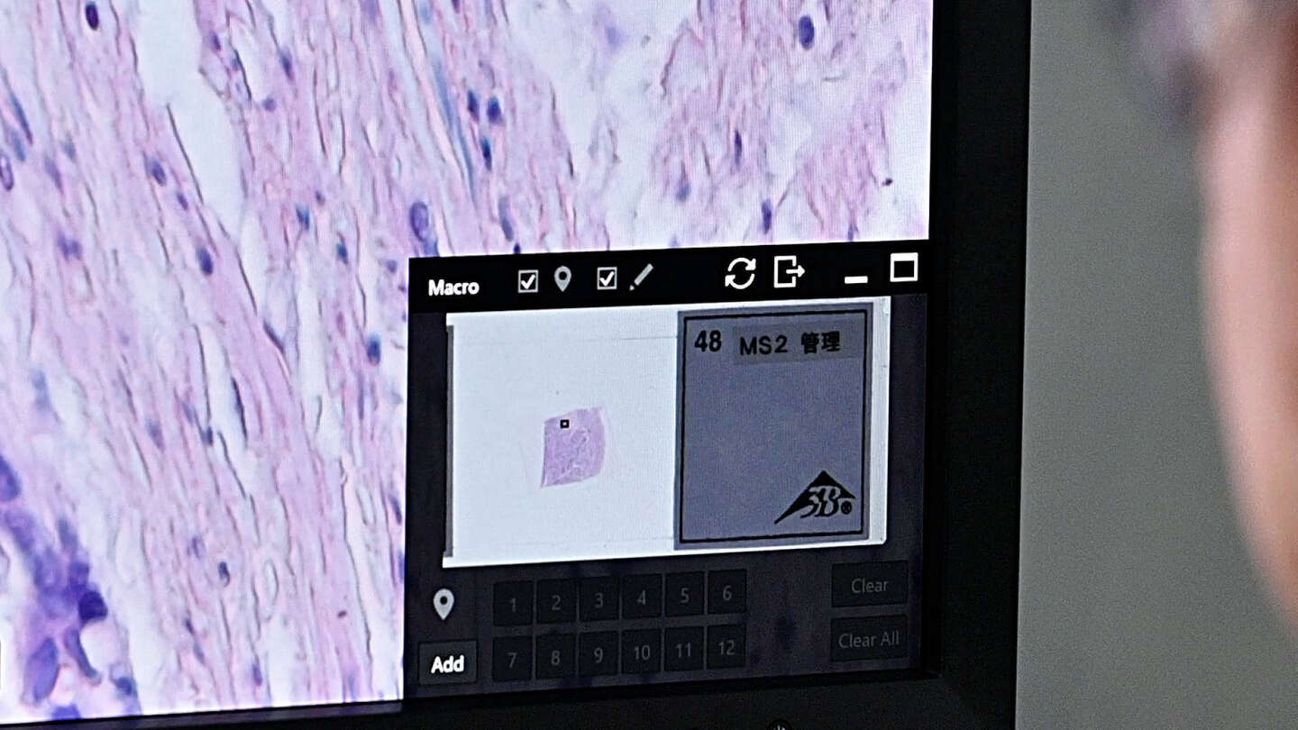 Interviews | ECLIPSE Ui | Digital Microscopes | Microscope Products ...