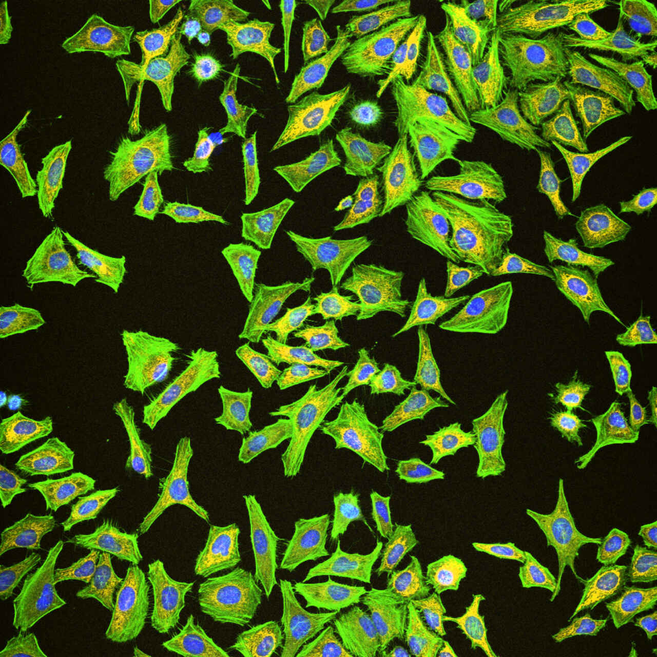 S Plan Fluor LWD Series | Optics | Microscope Products | Nikon Instruments Inc.