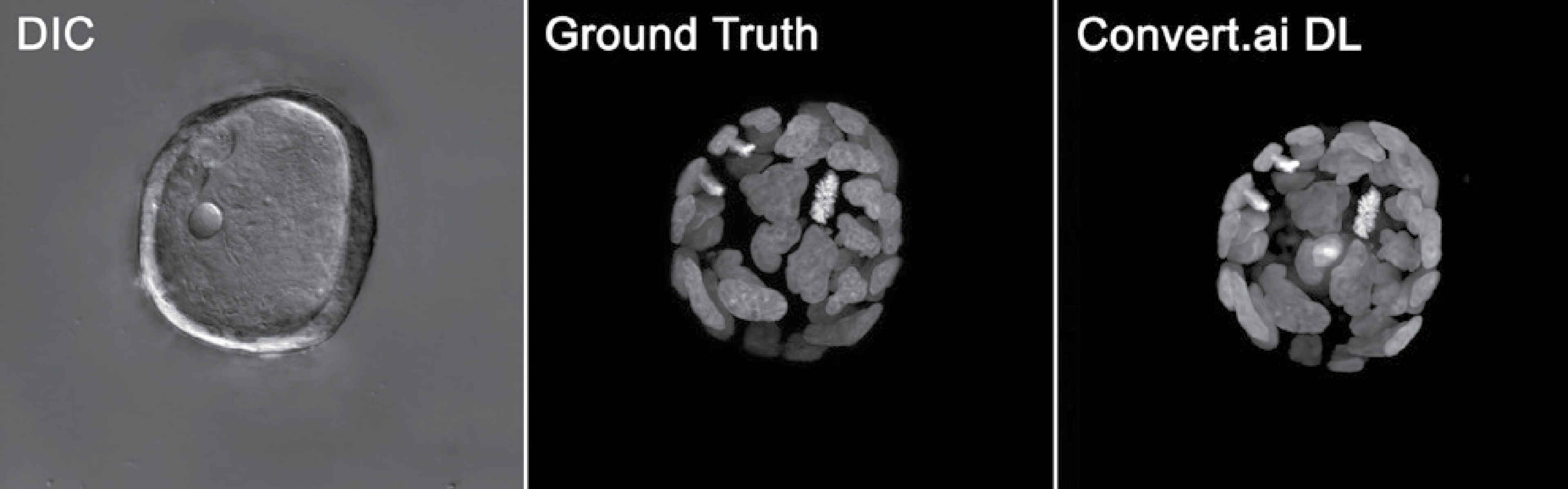 Deep Learning in Microscopy | Life Sciences | Solutions | Nikon Europe B.V.